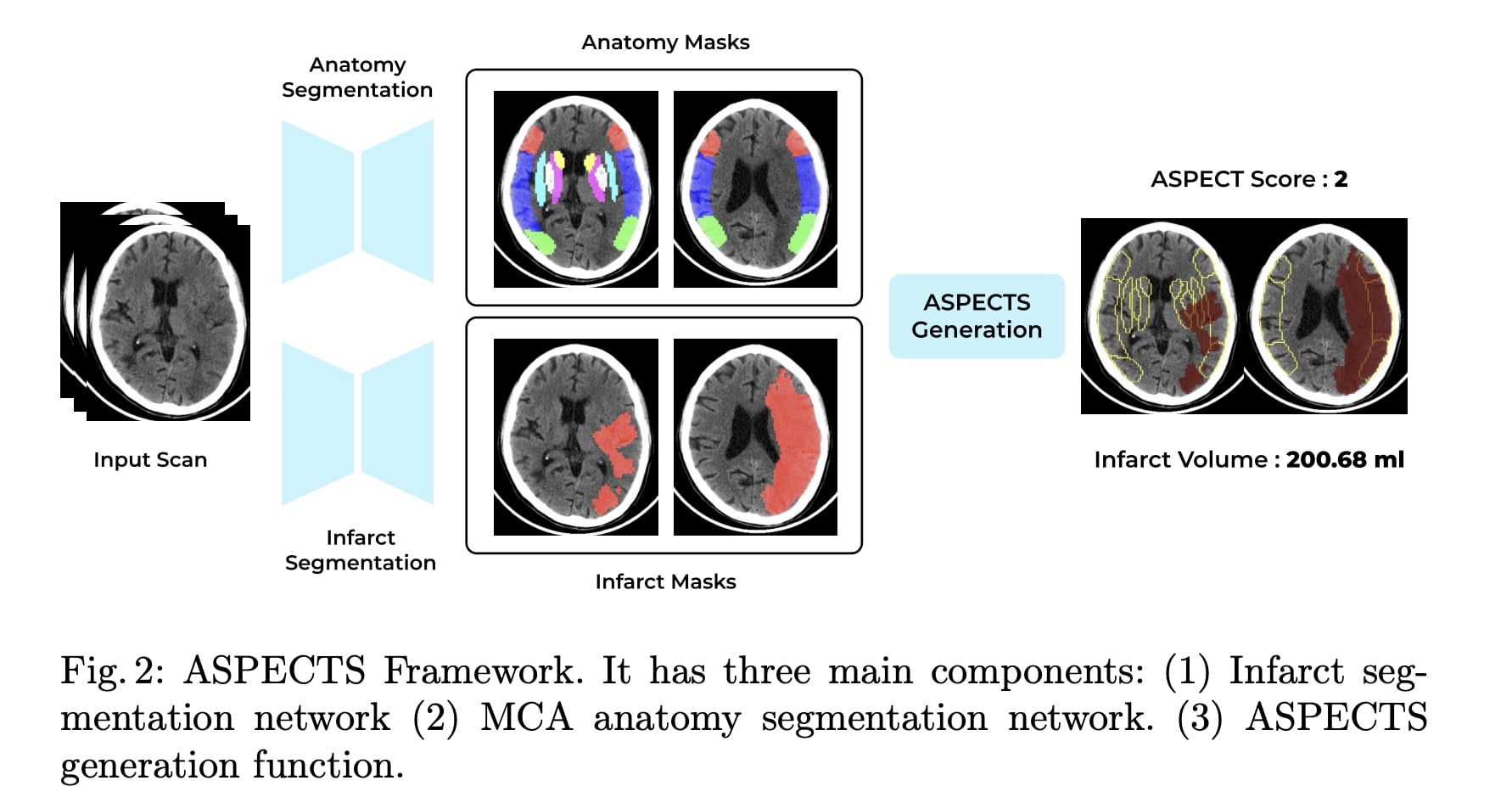 Deep-ASPECTS: A Segmentation-Assisted Model for Stroke Severity Measurement | Mukul's Blog